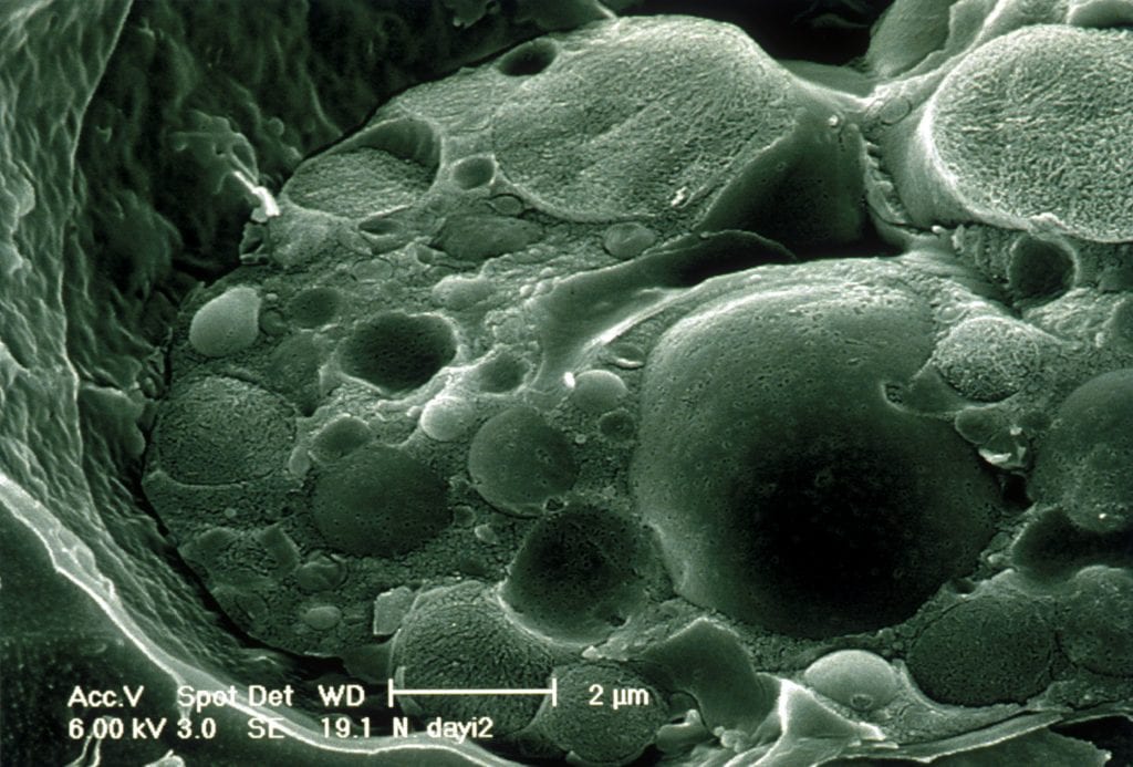 Chytrid_Fungus (Wikimedia Commons) - Earth Buddies