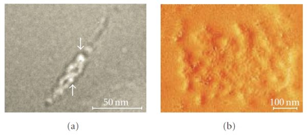 High-resolution_transmission_electron_microscopy_image_of_chitin ...